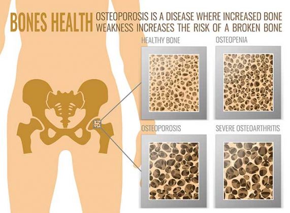 Kefir 101: Nutrition Facts, Health Benefits, and Side Effects