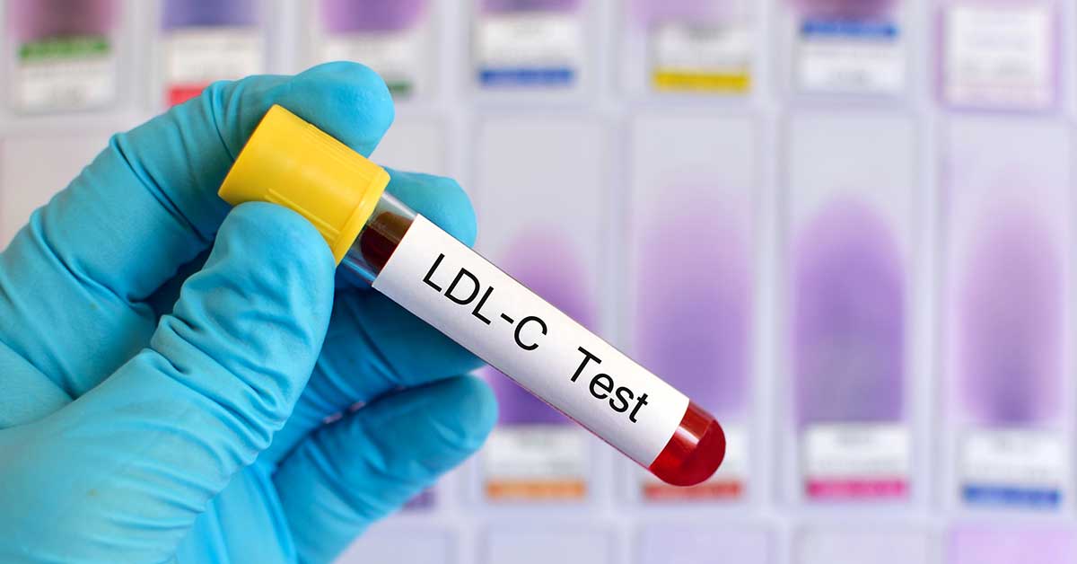 15 Foods That May Lower LDL Cholesterol - Nutrition Advance